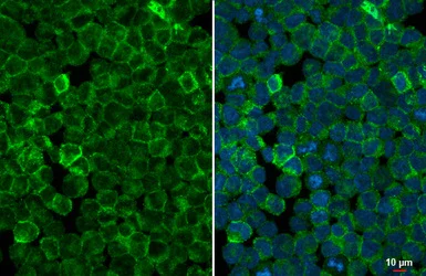 Anti-StAR antibody [HL1362] - BSA and Azide free (ab307801) | Abcam