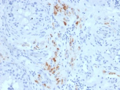 Anti-StAR antibody [STAR/2140] (ab238056) | Abcam