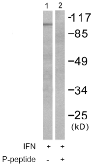 Anti-STAT2 (phospho Y690) antibody (ab53132) | Abcam