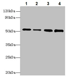 Anti-STK38L/Ndr2 antibody (ab235304) | Abcam