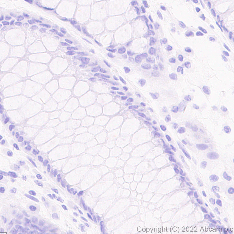 Anti-Strep-tag II antibody [EPR28119-43] (ab307676) | Abcam