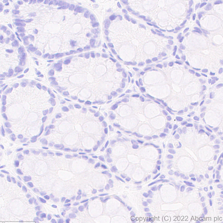 Anti-Strep-tag II antibody [EPR28119-43] (ab307676) | Abcam
