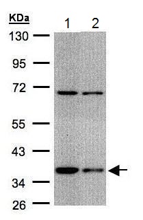 Anti-STUB1/CHIP antibody (ab228742) | Abcam
