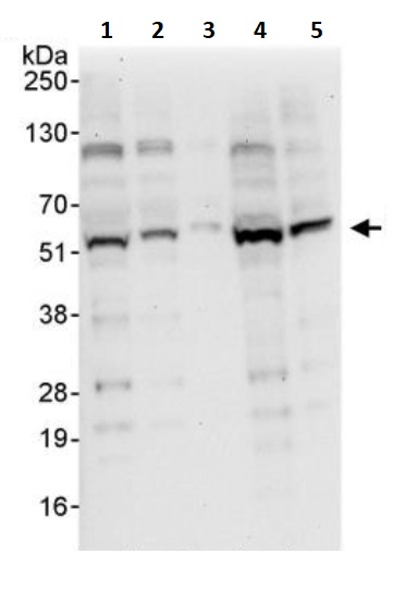 Anti-SUFU antibody (ab245428) | Abcam