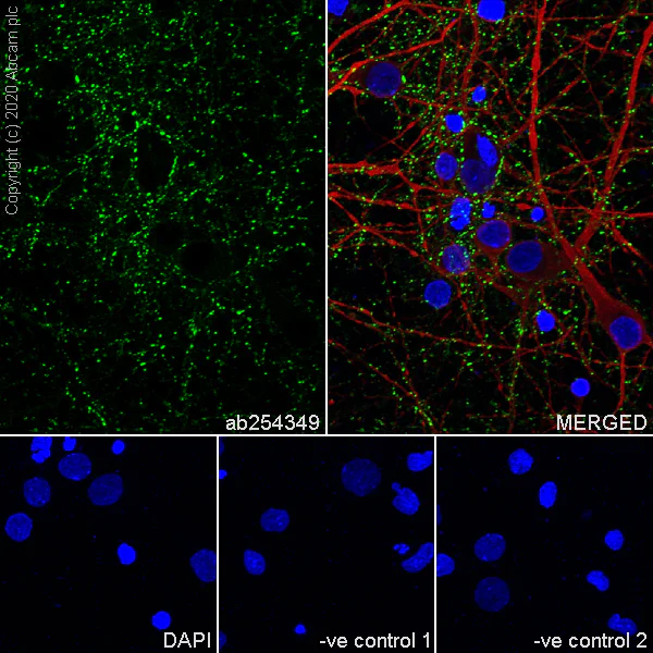 Synapsin I抗体[EPR23531-50] - Synaptic Marker (ab254349)| Abcam中文官网