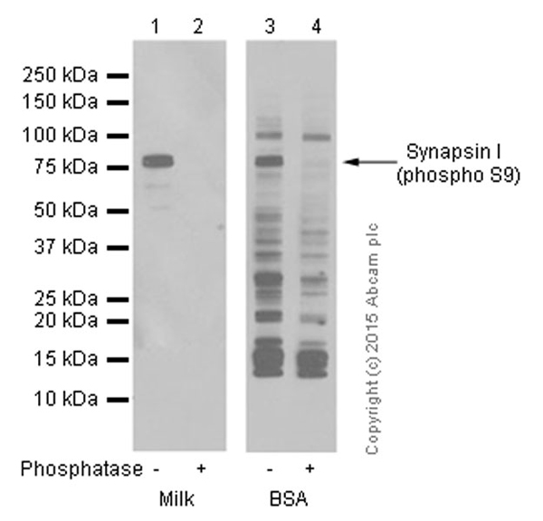 Synapsin I抗体- Synaptic Marker (ab64581)| Abcam中文官网