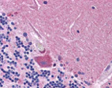 Synaptogyrin 1抗体 (ab113886)| Abcam中文官网