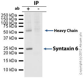 Anti-Syntaxin 6 antibody [3D10] - Golgi Membrane Marker (ab12370) | Abcam