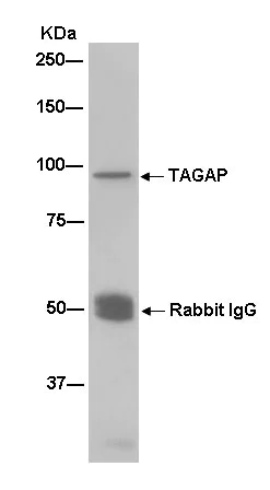 Anti-TAGAP antibody [EPR15593] (ab187664) | Abcam