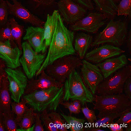 TAGLN/Transgelin抗体 (ab14106)| Abcam中文官网
