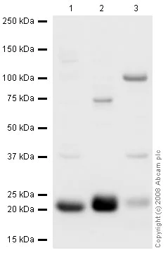 Anti-TAGLN/Transgelin antibody. Rabbit polyclonal (ab14106) | Abcam