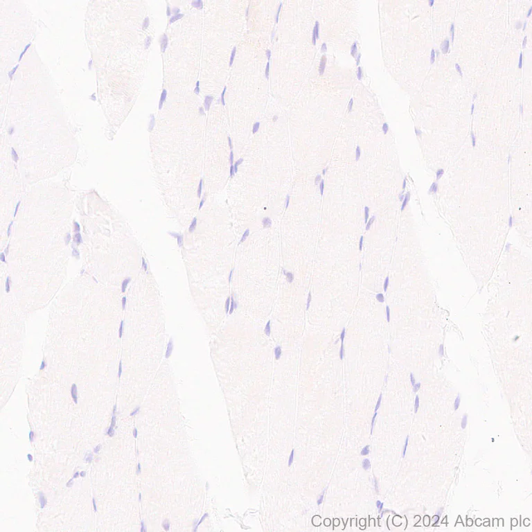 Anti-TAGLN/Transgelin antibody [EPR21215] (ab227566) | Abcam