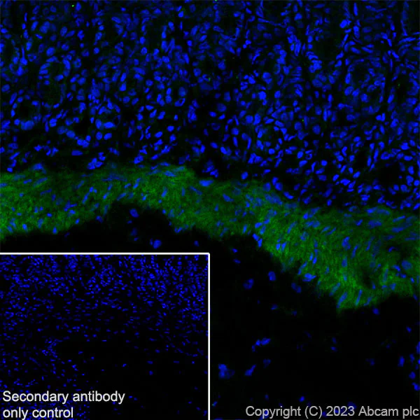 Anti-TAGLN/Transgelin antibody [RM1076] - BSA and Azide free (ab316021 ...