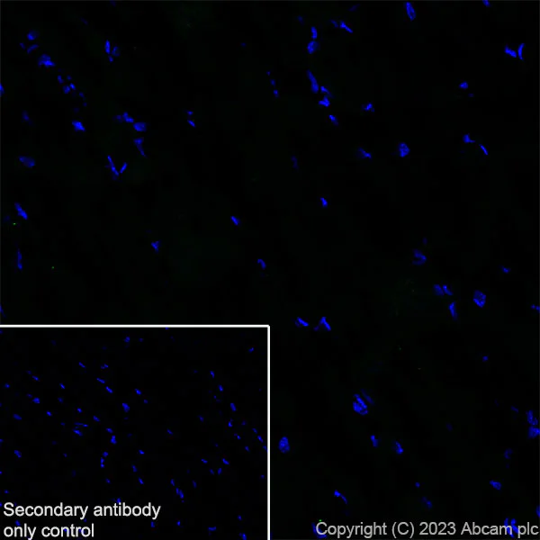 Anti-TAGLN/Transgelin antibody [RM1076] - BSA and Azide free (ab316021 ...