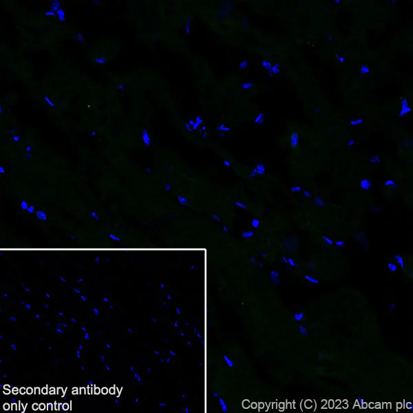 Anti-TAGLN/Transgelin antibody [RM1076] - BSA and Azide free (ab316021 ...