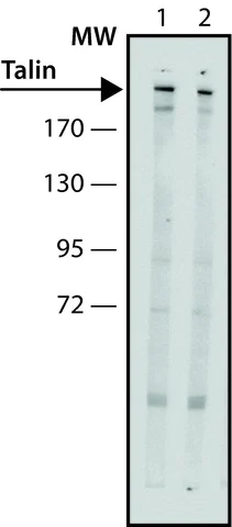 Anti-Talin 1 and 2 antibody [8D4] (ab11188) | Abcam