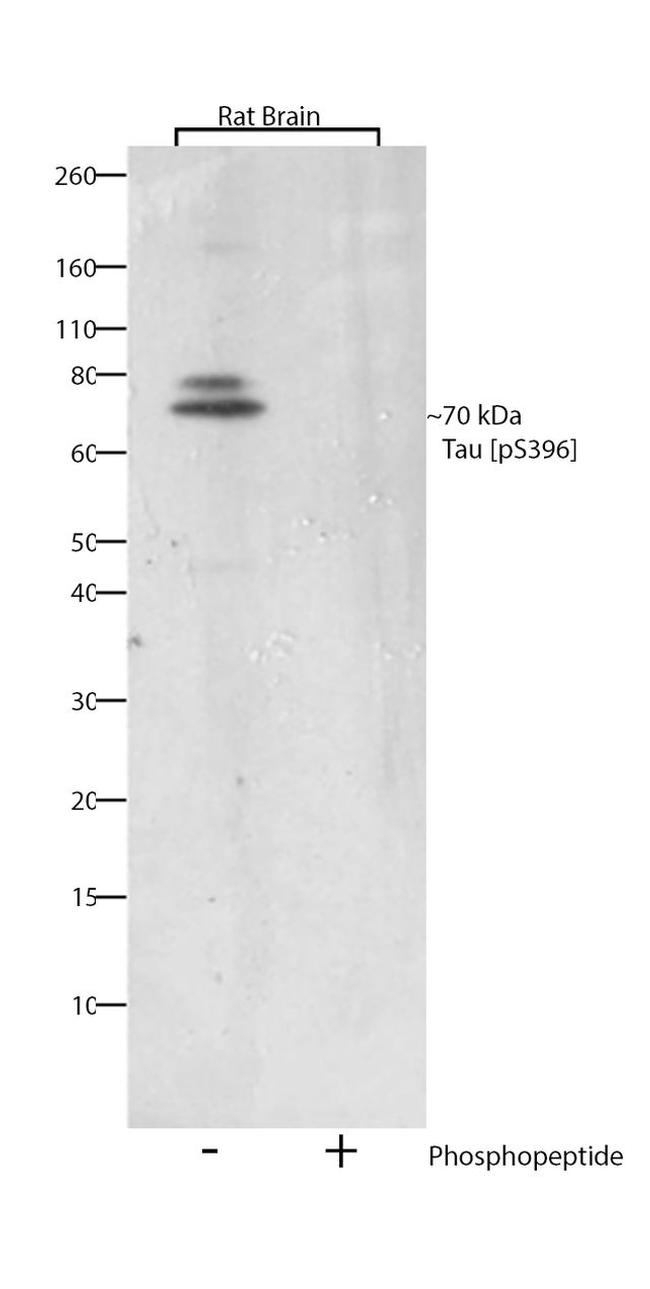 Anti-Tau (phospho S396) Antibody [RP23040068] (ab313407) | Abcam