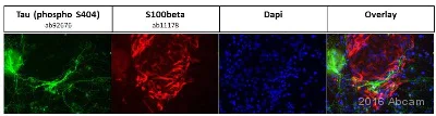 Anti-Tau (phospho S404) antibody [EPR2605] (ab92676) | Abcam