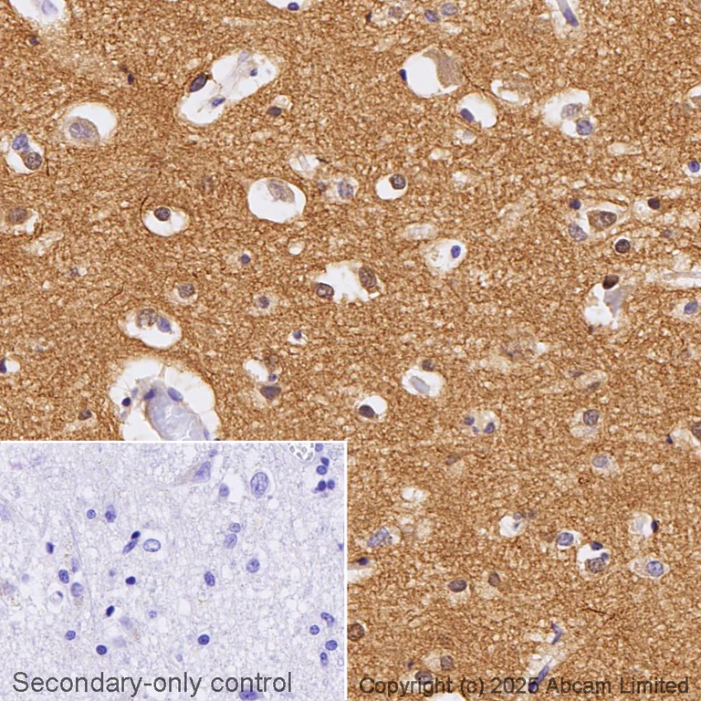 Anti-Tau (phospho S404) antibody [EPR2605] (ab92676) | Abcam