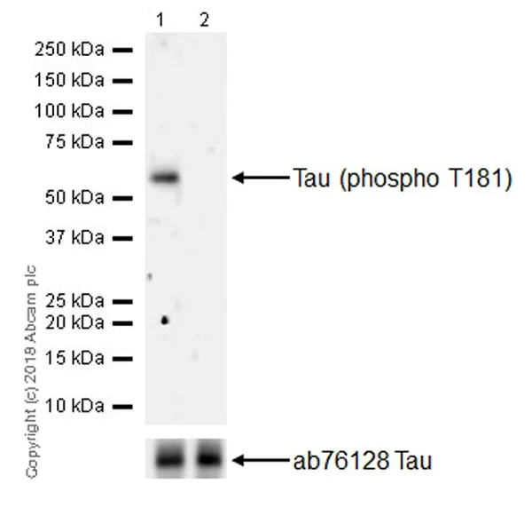 Anti-Tau (phospho T181) antibody [EPR22064] (ab223192) | Abcam