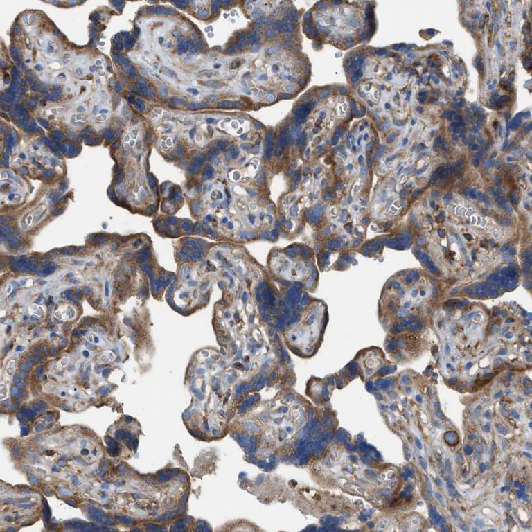 Anti-TBC1D15 antibody (ab121396) | Abcam