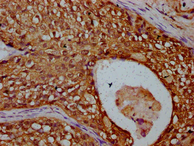 Anti-TBCD/SSD1 antibody (ab238761) | Abcam