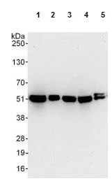 Anti-TBP-1 antibody (ab125164) | Abcam