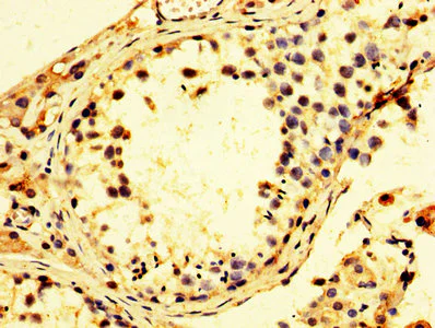 Anti-TBP-1 antibody (ab239029) | Abcam