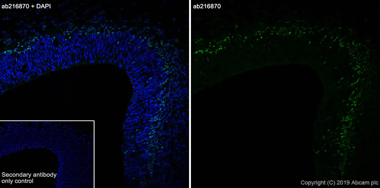Anti-TBR2 / Eomes antibody [EPR21950-241] (ab216870) | Abcam