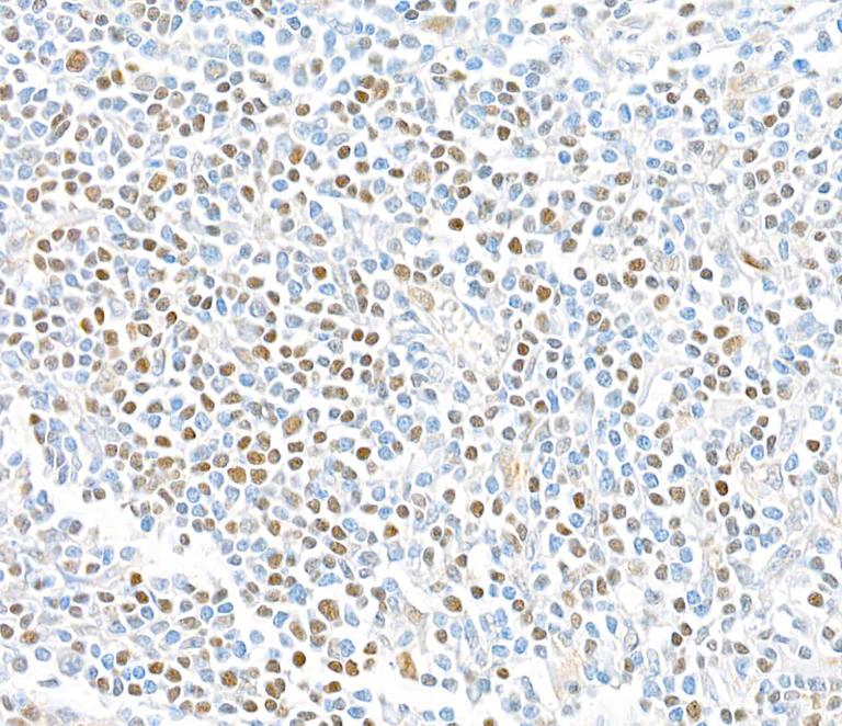 Anti-TCF1/TCF7 antibody [BLR228K] - BSA free (ab314082) | Abcam