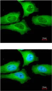 TCP1 epsilon/CCT5抗体 (ab96344)| Abcam中文官网
