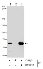 Anti-TCP1 epsilon/CCT5 antibody (ab96344) | Abcam