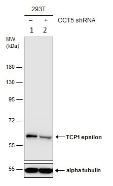 Anti-TCP1 epsilon/CCT5 antibody (ab96344) | Abcam