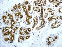 Anti-TCP1 epsilon/CCT5 antibody [EPR7562] (ab129016) | Abcam