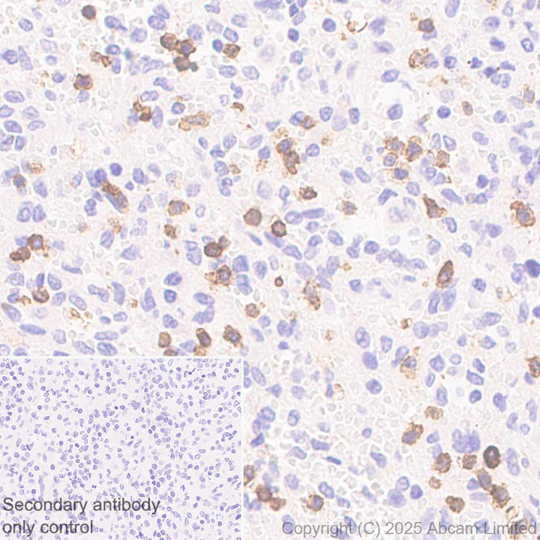 Anti-TCR alpha antibody [EPR29621-40] (ab324527) | Abcam