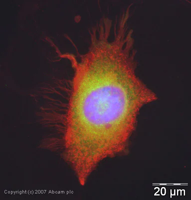 Anti-TCTP antibody (ab37506) | Abcam