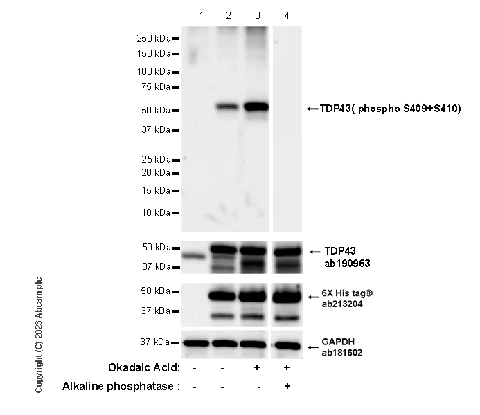 Anti-TDP43 (phospho S409 + pS410) antibody [EPR24512-120] - BSA and ...