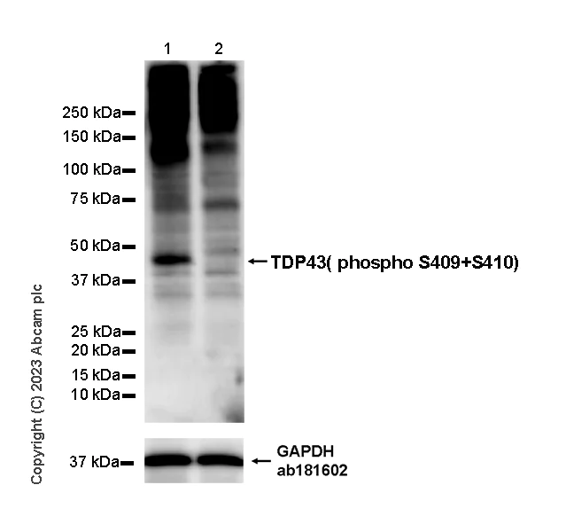 Anti-TDP43 (phospho S409 + pS410) antibody [EPR24512-120] - BSA and ...