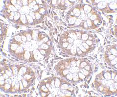 Anti-TEM1 antibody (ab67273) | Abcam