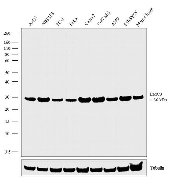Anti-TEM111 antibody [RP23040239] (ab308135) | Abcam