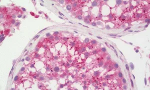 Anti-Ten-1 antibody - N-terminal (ab211297) | Abcam