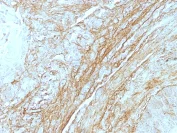Anti-Tenascin C antibody [T2H5] - BSA and Azide free (ab212462) | Abcam