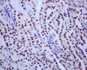 Anti-TFE3 antibody [EPR11591] - BSA and Azide free (ab231112) | Abcam