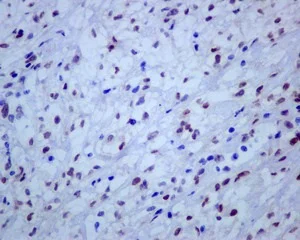 Anti-TFE3 antibody [EPR11591] - BSA and Azide free (ab231112) | Abcam