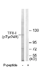Anti-TFII I (phospho Y248) antibody (ab63344) | Abcam