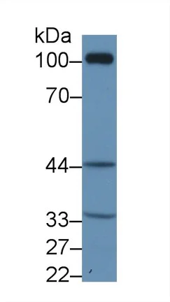 Thromboxane A2 receptor/TBXA2R抗体- Cytoplasm Marker (ab233288)| Abcam中文官网