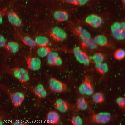 thyroid hormone receptor alpha
