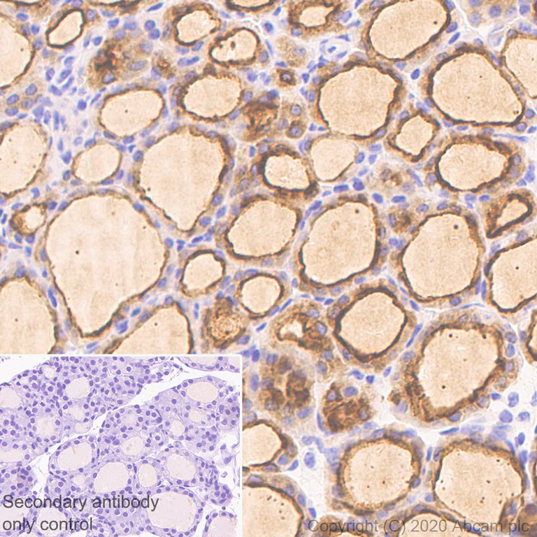 Anti-Thyroid Peroxidase/TPO antibody [EPR23574-405] (ab278525) | Abcam