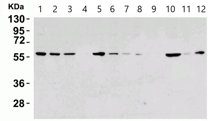 Anti-TIM 1 antibody. Rabbit polyclonal (ab47635) | Abcam