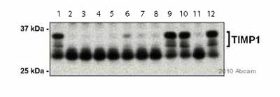 Anti-TIMP1 antibody - Carboxyterminal end (ab38978) | Abcam